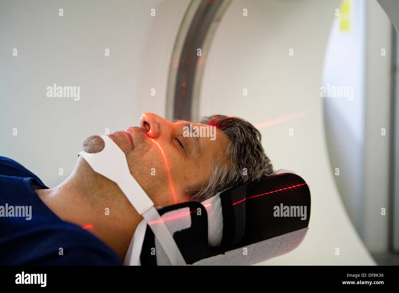 Cat scan human skull hi-res stock photography and images - Alamy