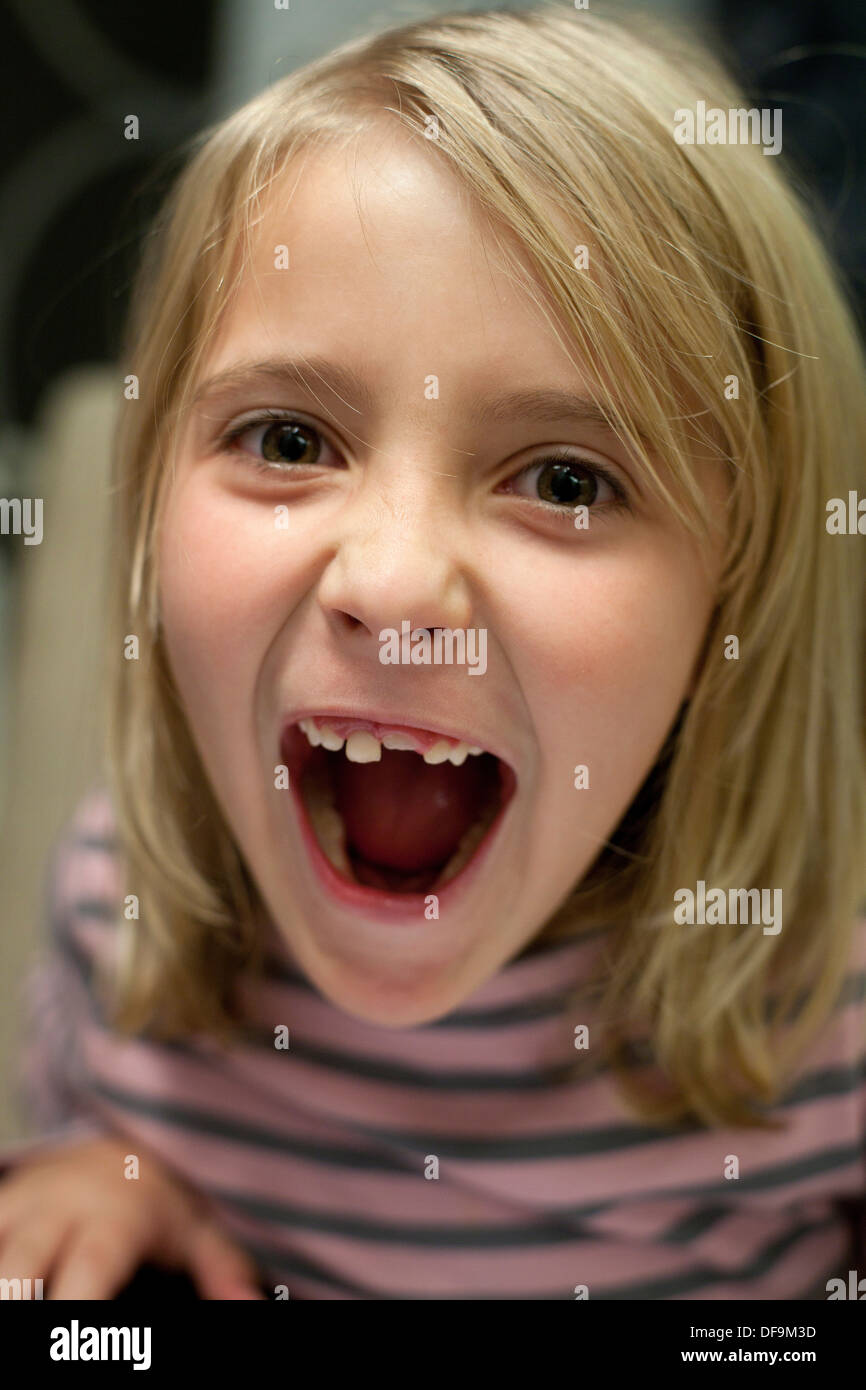 Broken tooth hi-res stock photography and images - Alamy