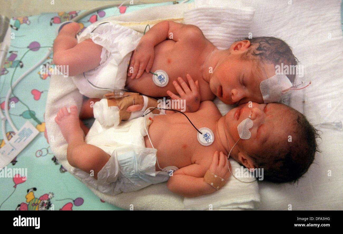 "Millennium baby" Mircam (back) and his twin Mircem in the incubator in ...