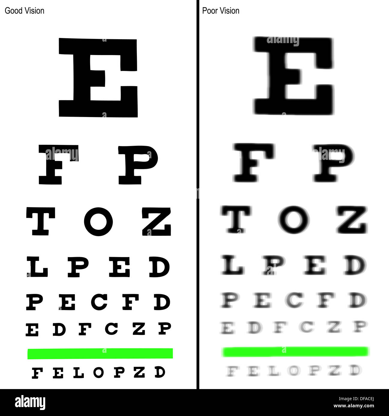 Poor visual acuity hi-res stock photography and images - Alamy