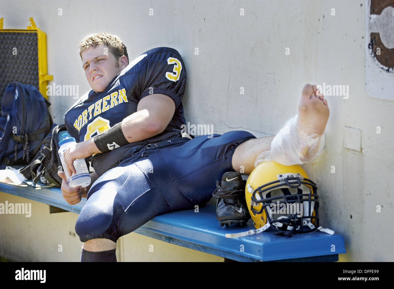 Dislocated Arm High School Football