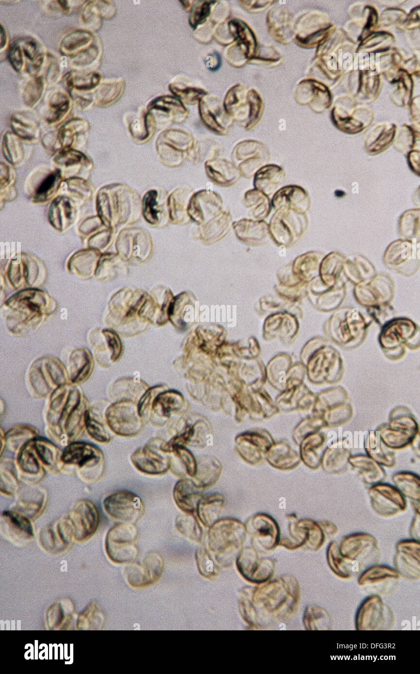 Vegetal cell microscope hi-res stock photography and images - Alamy