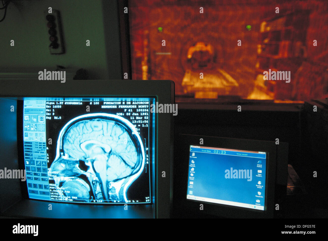 Nuclear medicine scan brain hi-res stock photography and images - Alamy