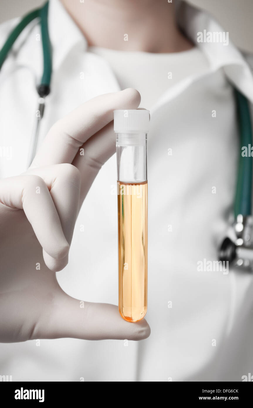 Doctor's hand with urine sample Stock Photo - Alamy