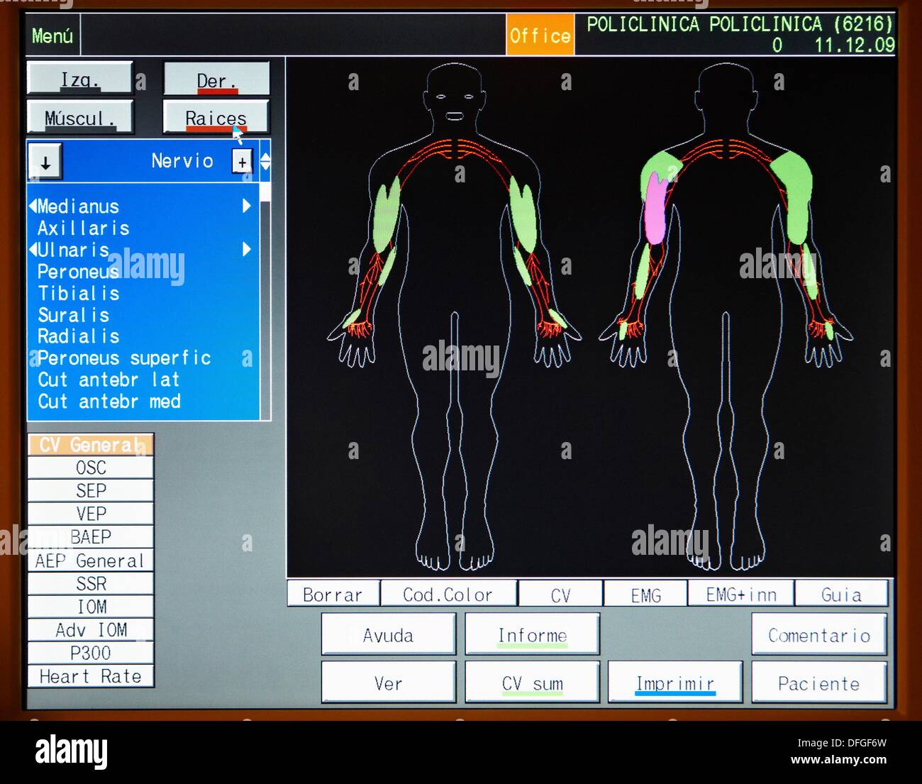 Emg test hi-res stock photography and images - Alamy