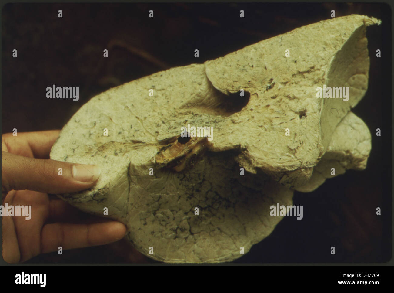 This photograph shows a normal lung compared to one affected by black ...