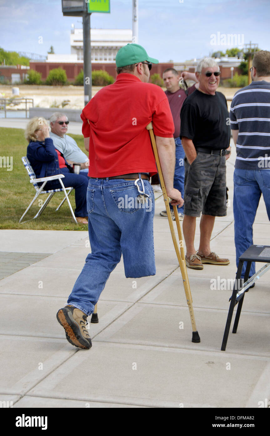 Amputated leg hi-res stock photography and images - Alamy