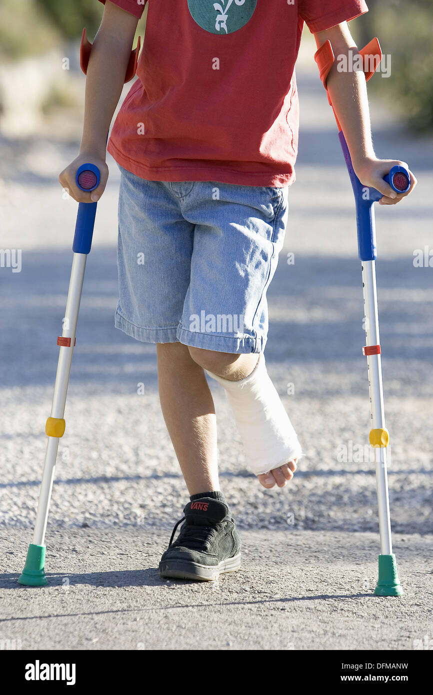 Children leg fracture hi-res stock photography and images - Alamy
