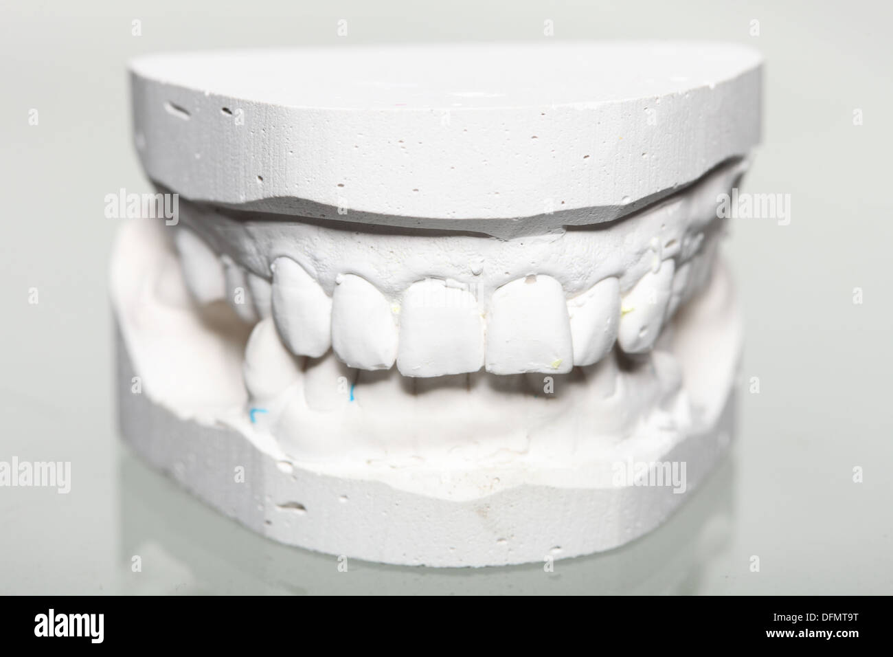 Dental casting gypsum model plaster cast stomatologic human jaws ...