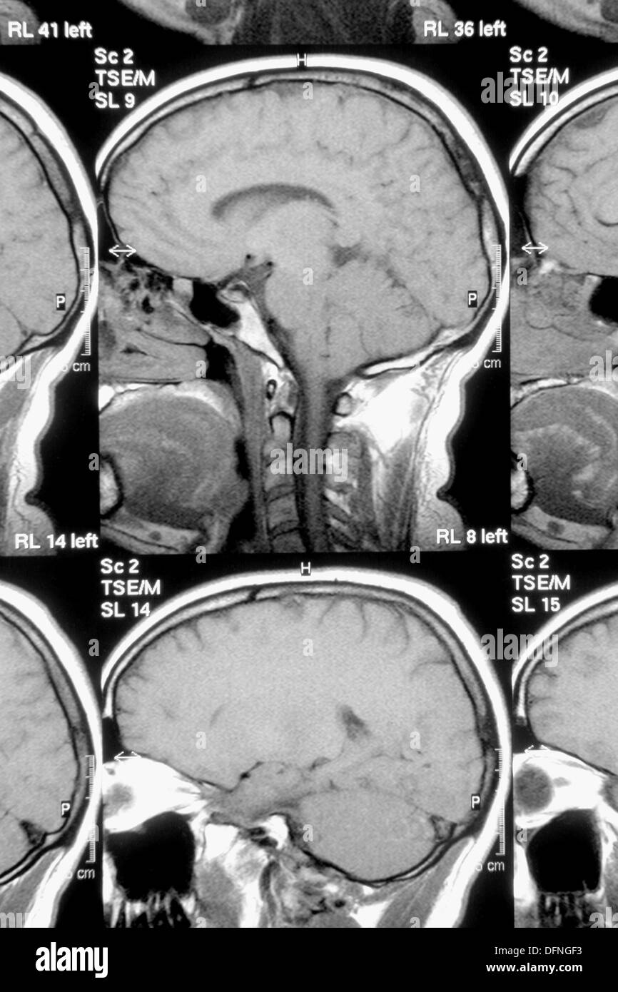 Which are the sagittal plane Black and White Stock Photos & Images - Alamy