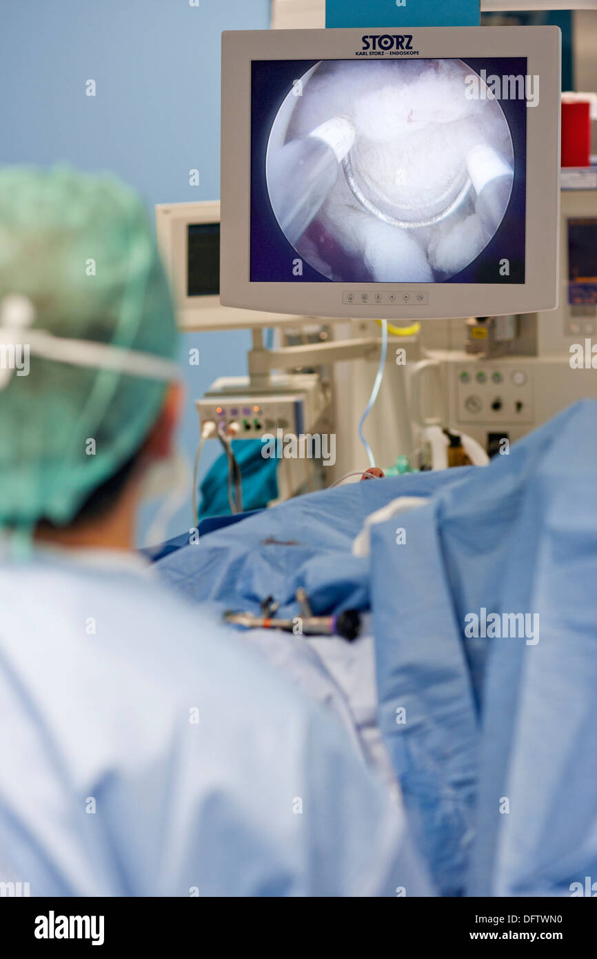 Prostate surgery bipolar turp transurethral hi-res stock photography ...