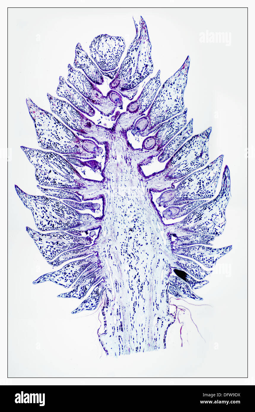 Female Pine Cone Microscope