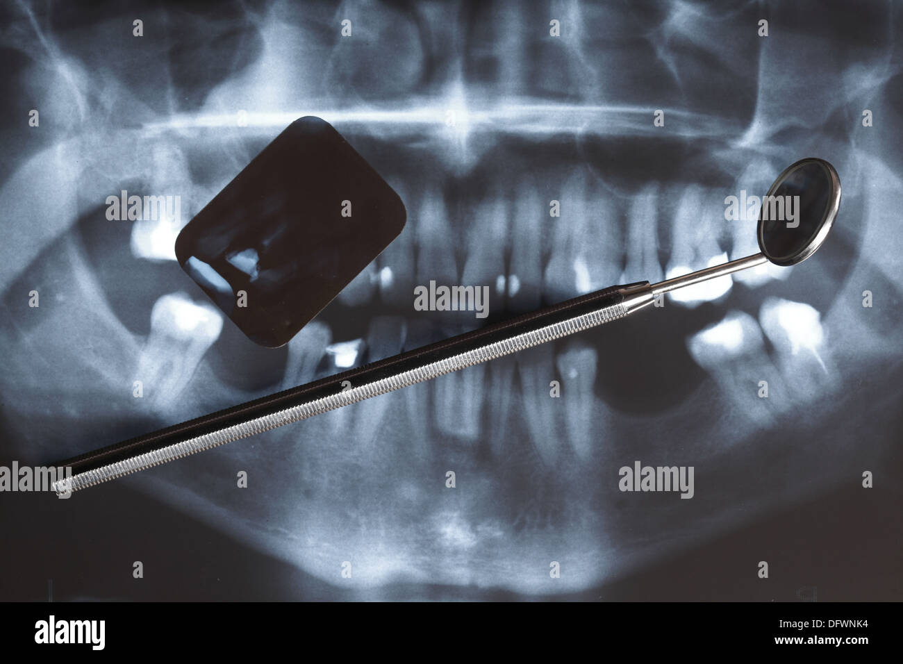 Panoramic x-ray image scan of humans teeth and dental mirror Stock ...