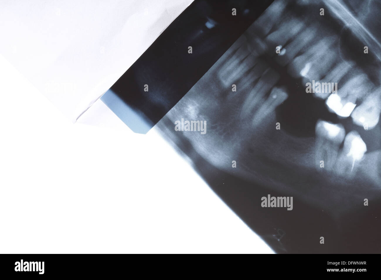 detail x-ray image scan of humans teeth Stock Photo - Alamy