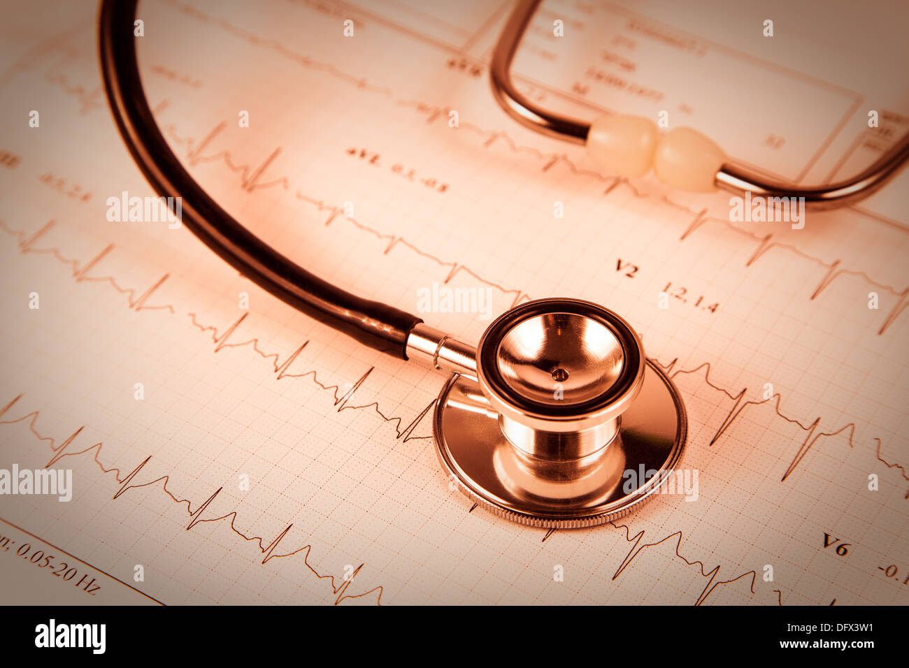 ECG heartbeat report with a stethoscope Stock Photo - Alamy