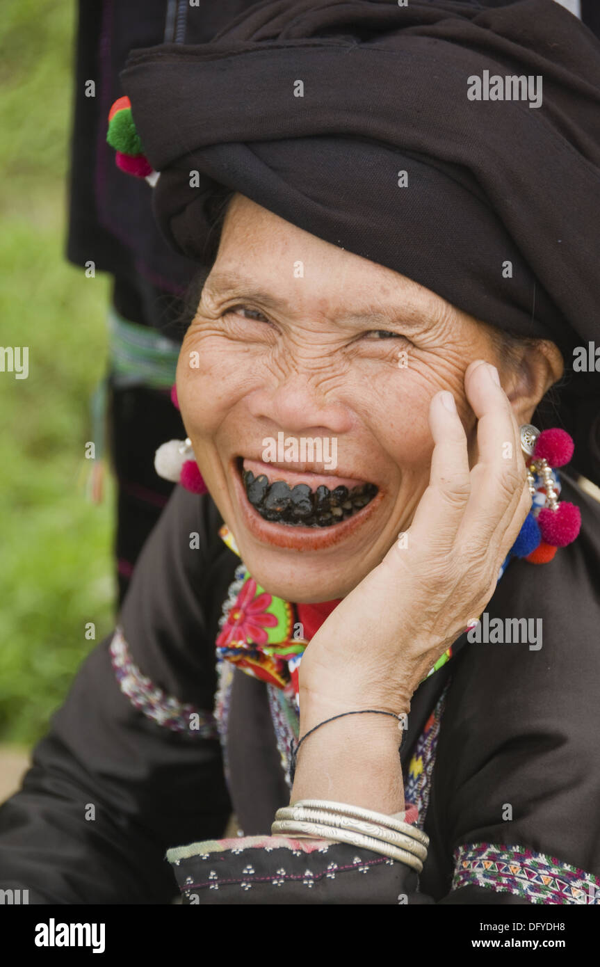 Black teeth vietnam hi-res stock photography and images - Alamy