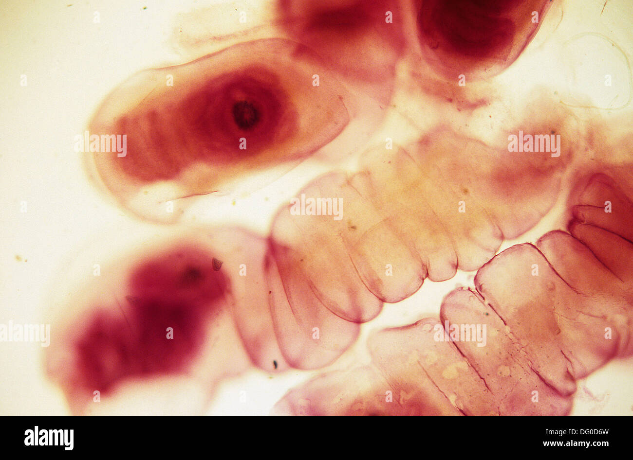 Cestoda Tapeworm High Resolution Stock Photography and Images - Alamy