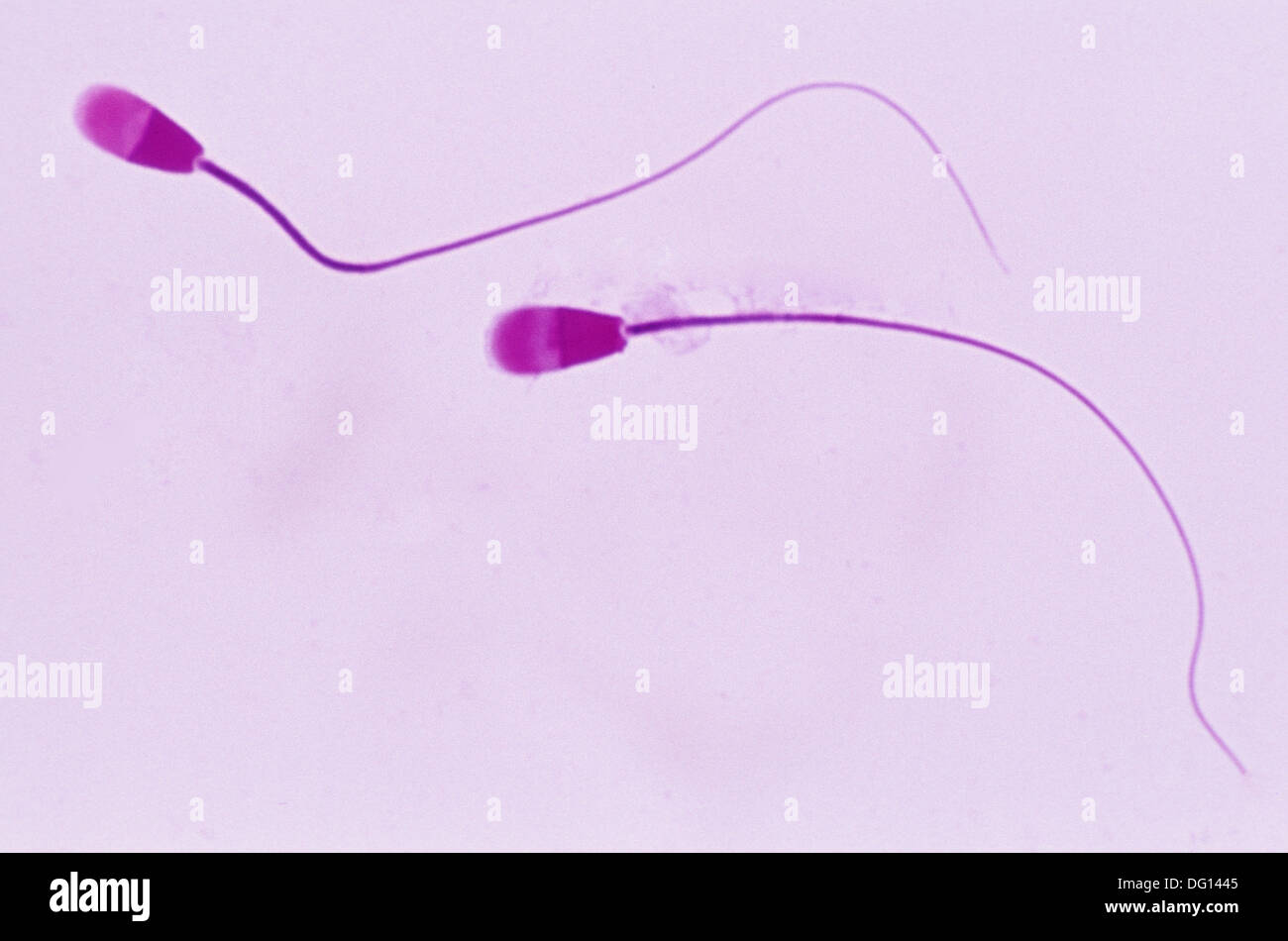 Sperm Cells Microscope Stock Photos & Sperm Cells Microscope Stock ...