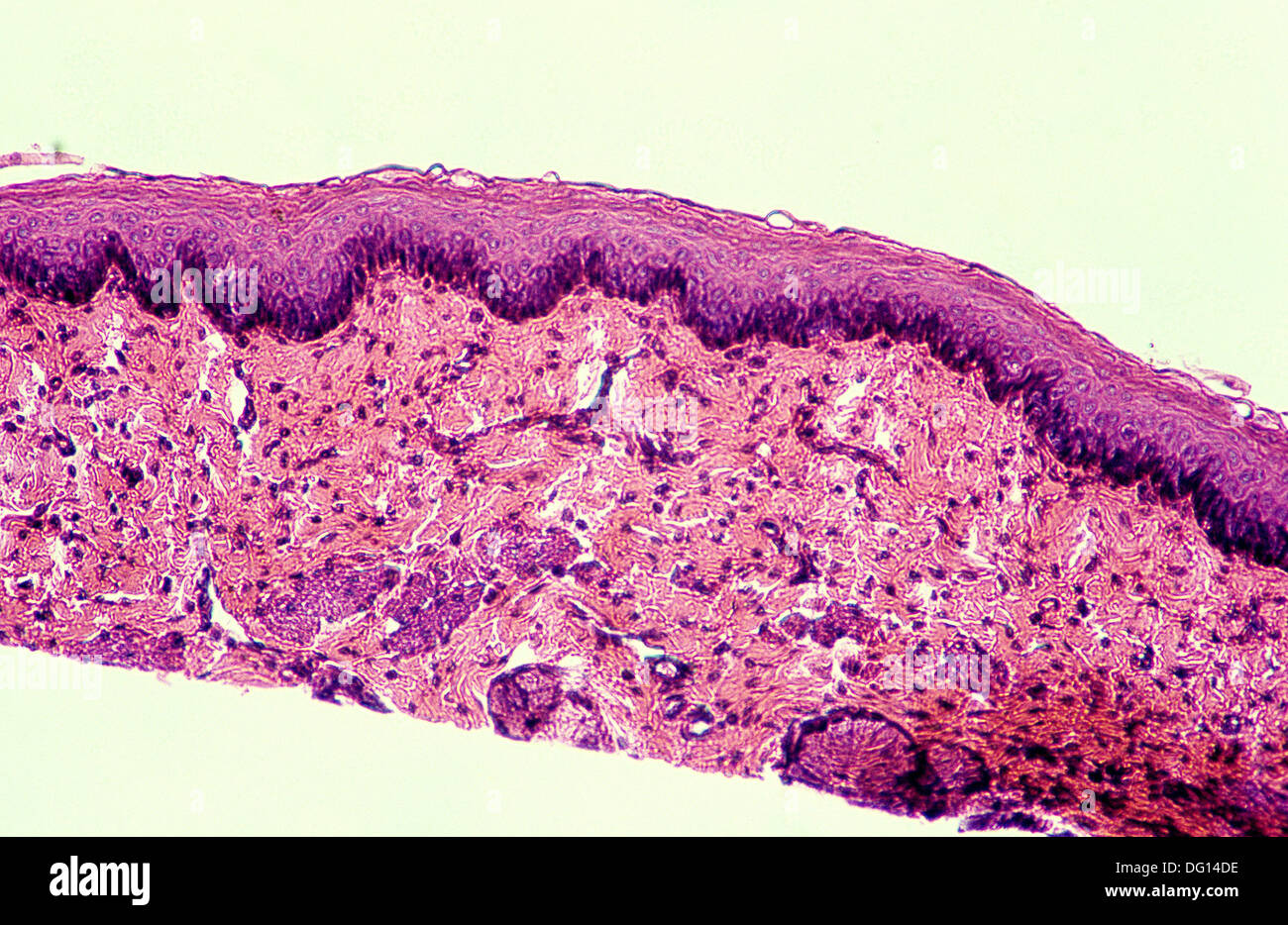 Epithelium High Resolution Stock Photography and Images - Alamy