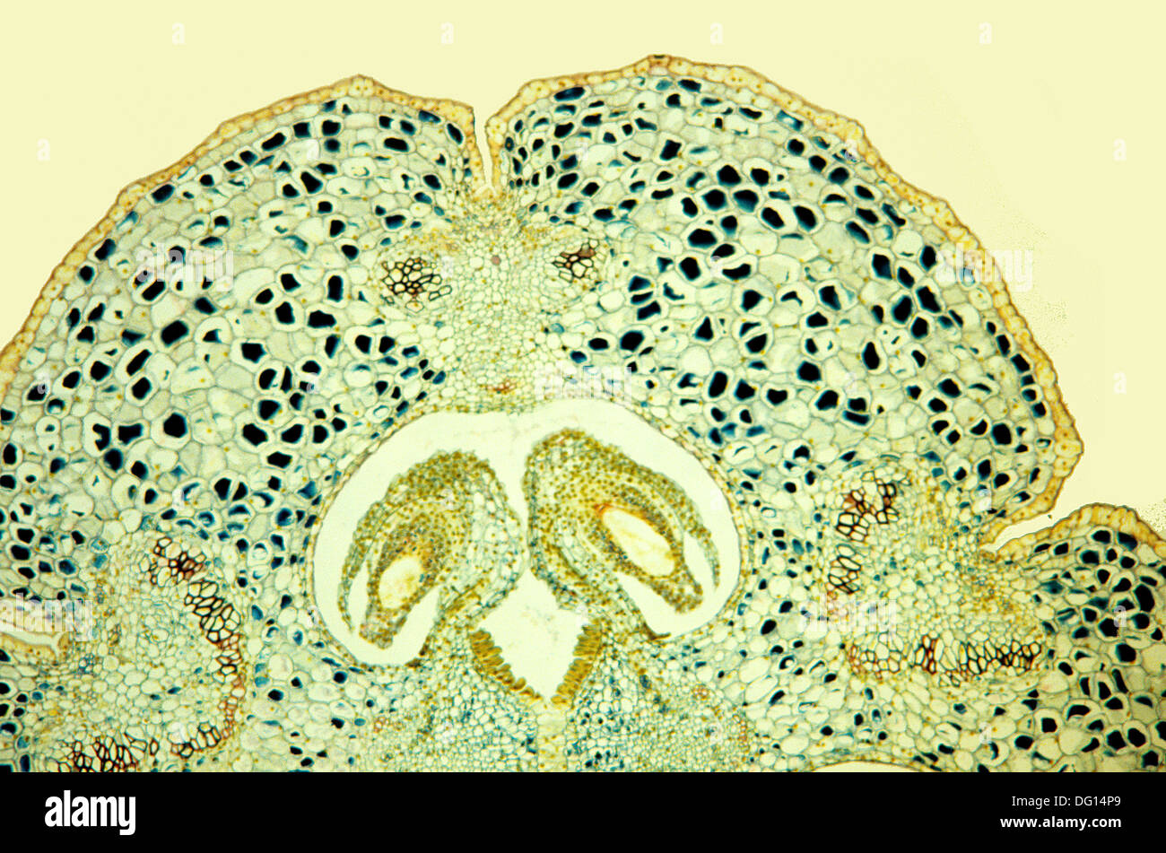 Ovary Section Stock Photos & Ovary Section Stock Images - Alamy