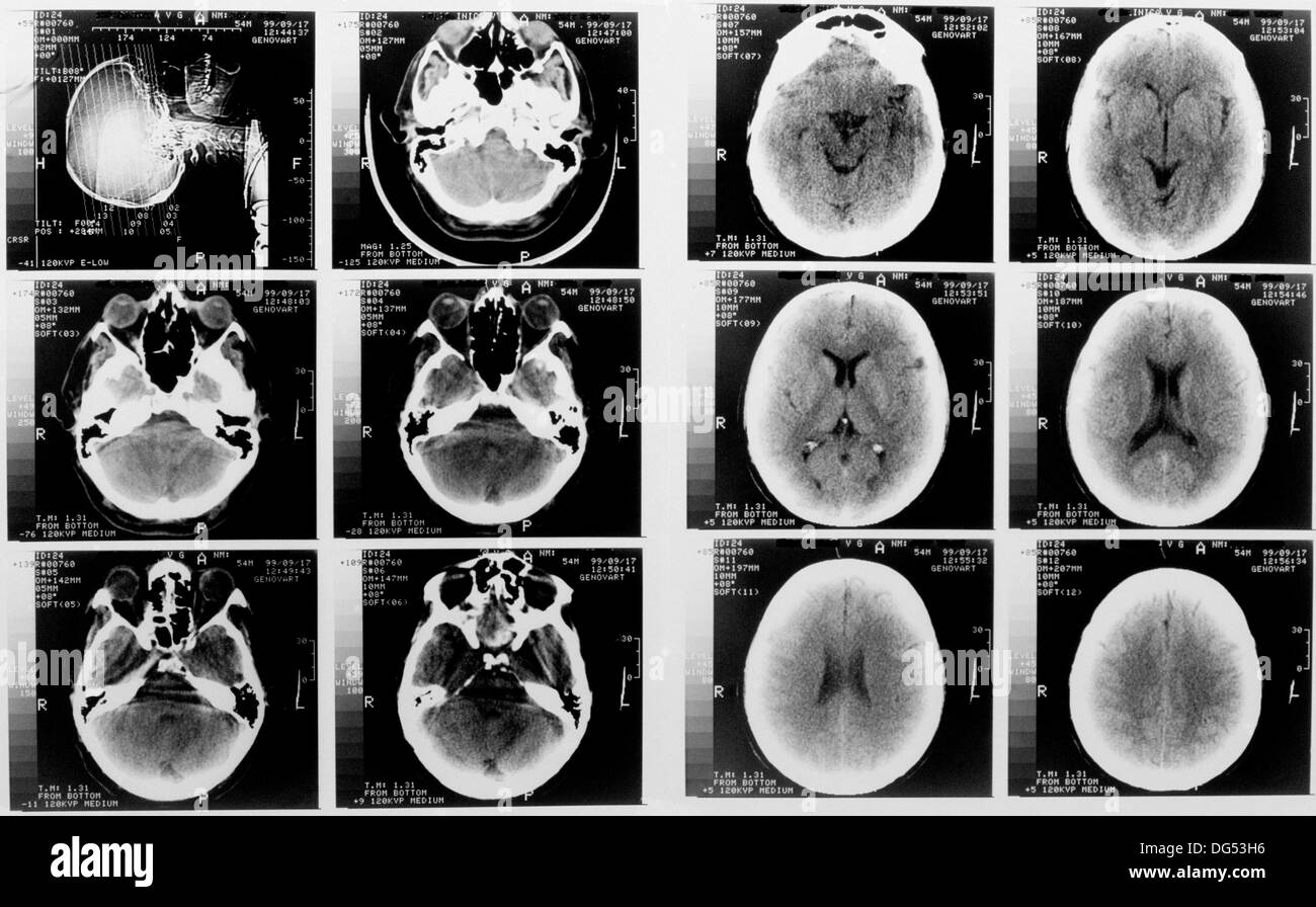 Diagnostic scans Black and White Stock Photos & Images - Alamy