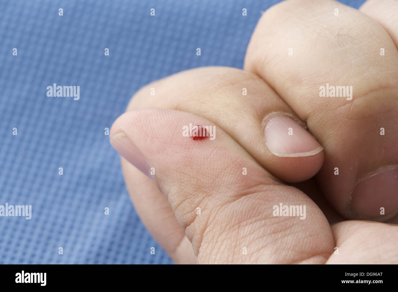 Pinched skin hi-res stock photography and images - Alamy