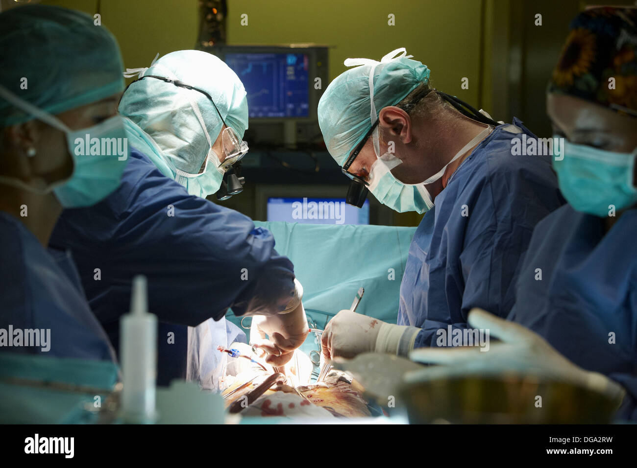 Aortic Valve Replacement High Resolution Stock Photography and Images ...