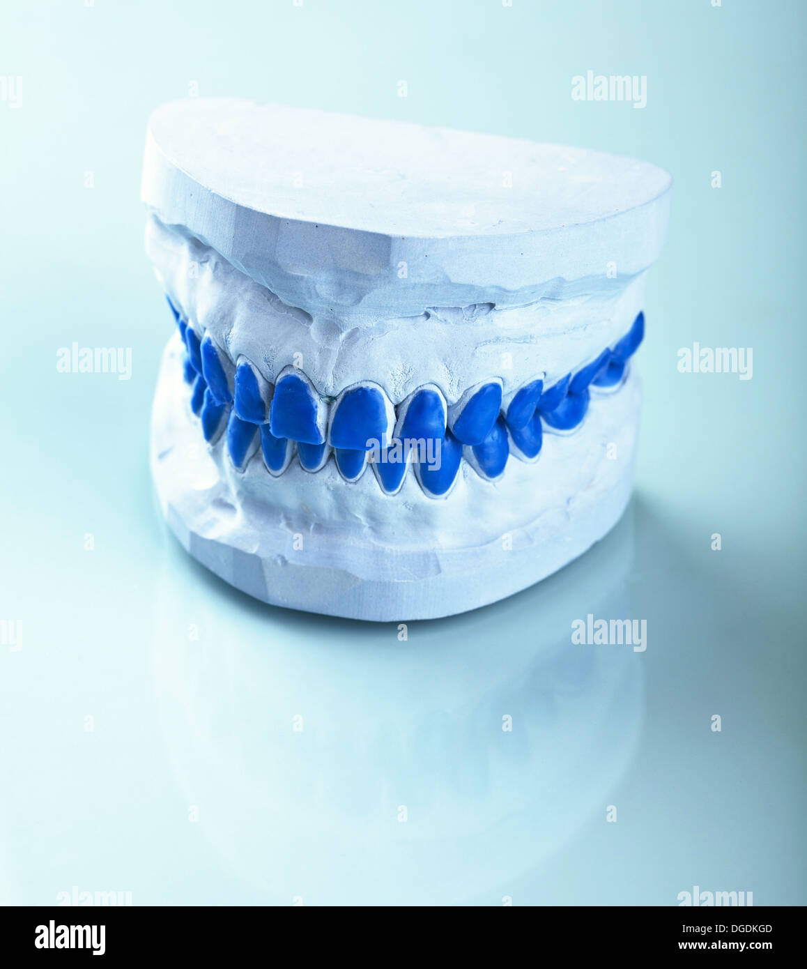 individual plaster dental molds to make trays Stock Photo - Alamy