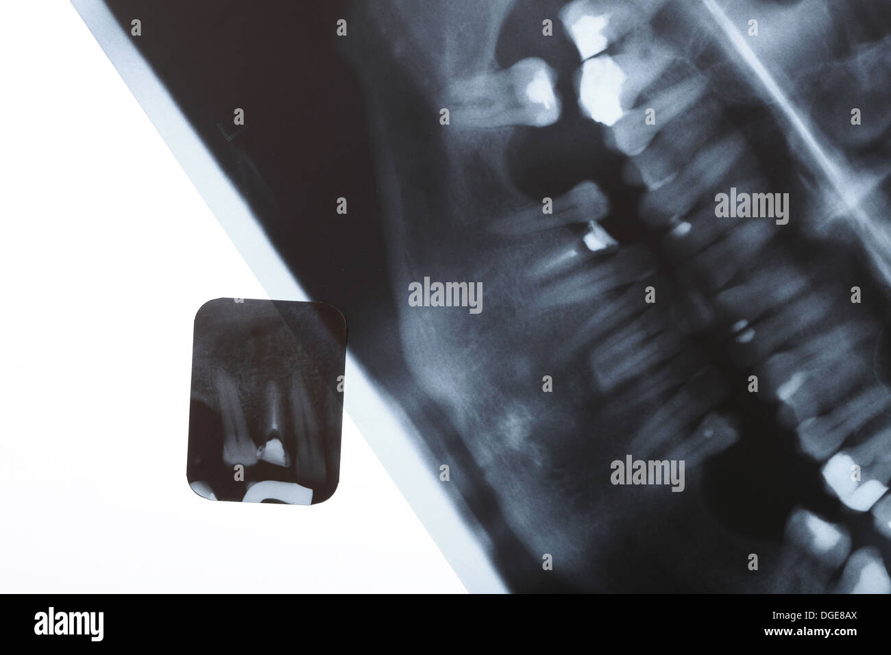 Panoramic and detail x-ray image scan of humans teeth Stock Photo - Alamy