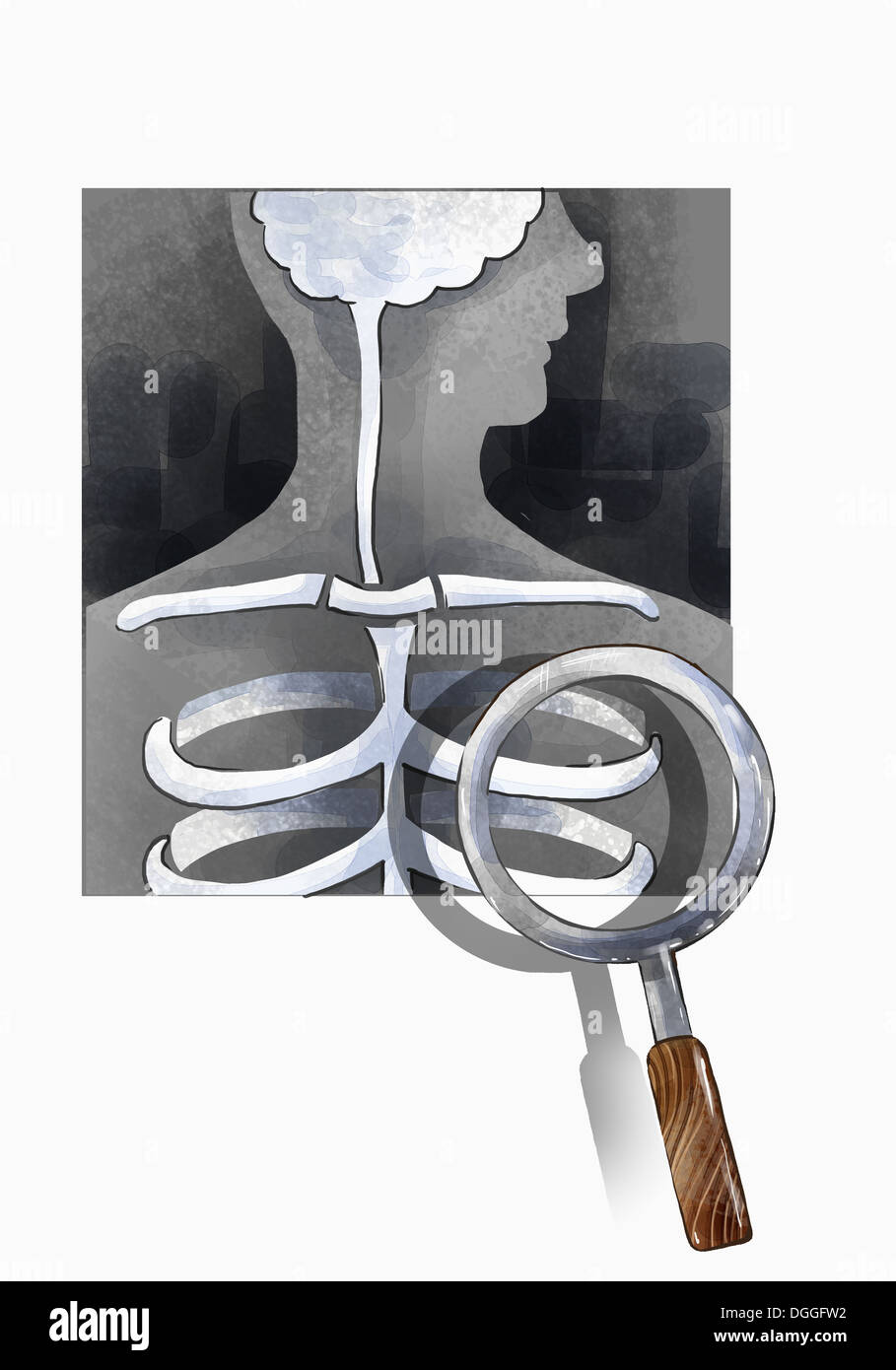 an illustration of a x-ray picture and a magnifying glass Stock Photo ...