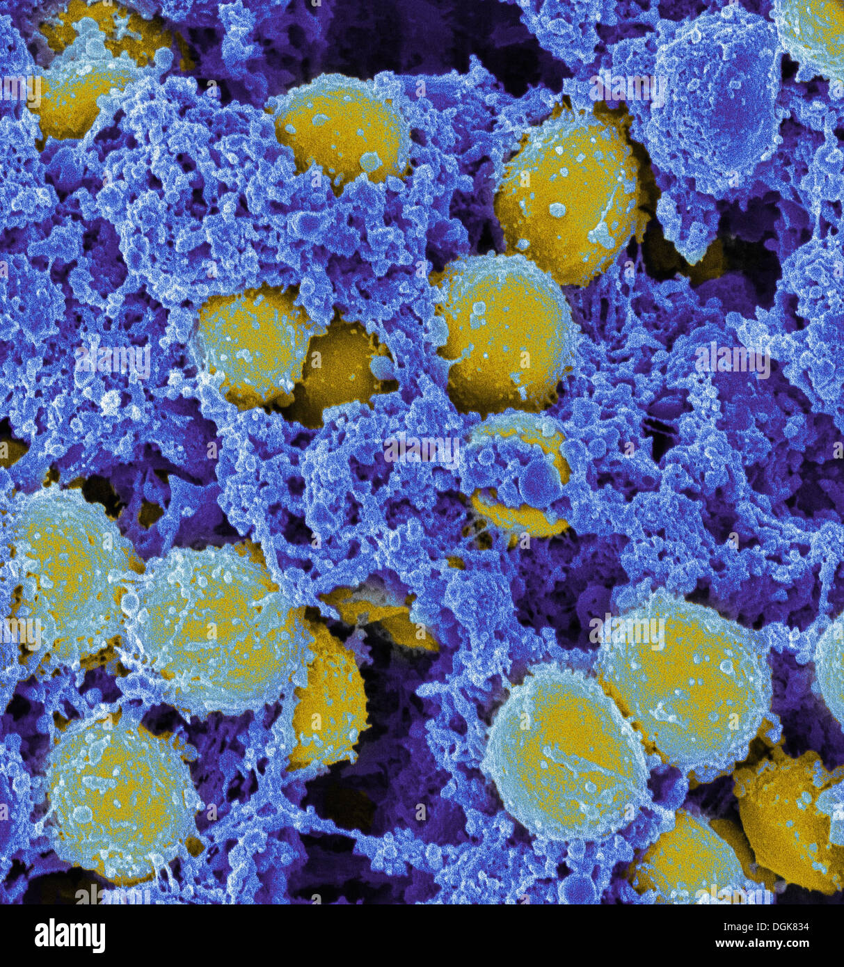 Mrsa microscope hi-res stock photography and images - Alamy