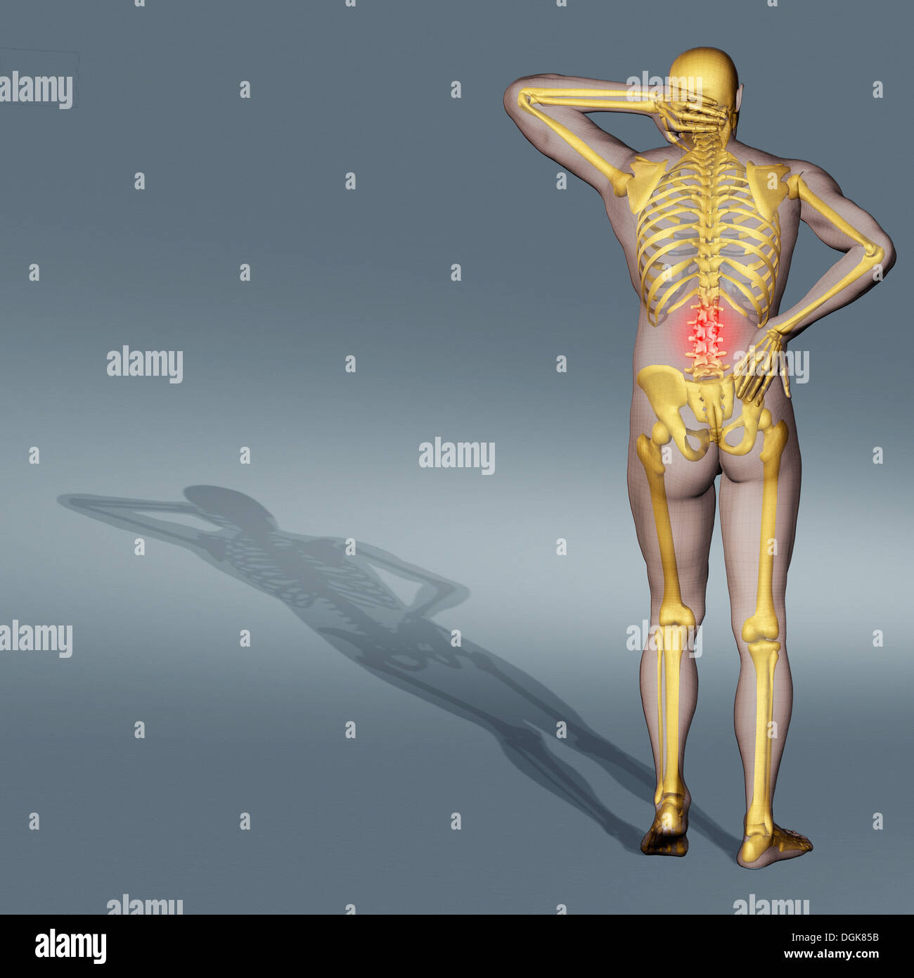 Computer-generated illustration of back pain Stock Photo - Alamy