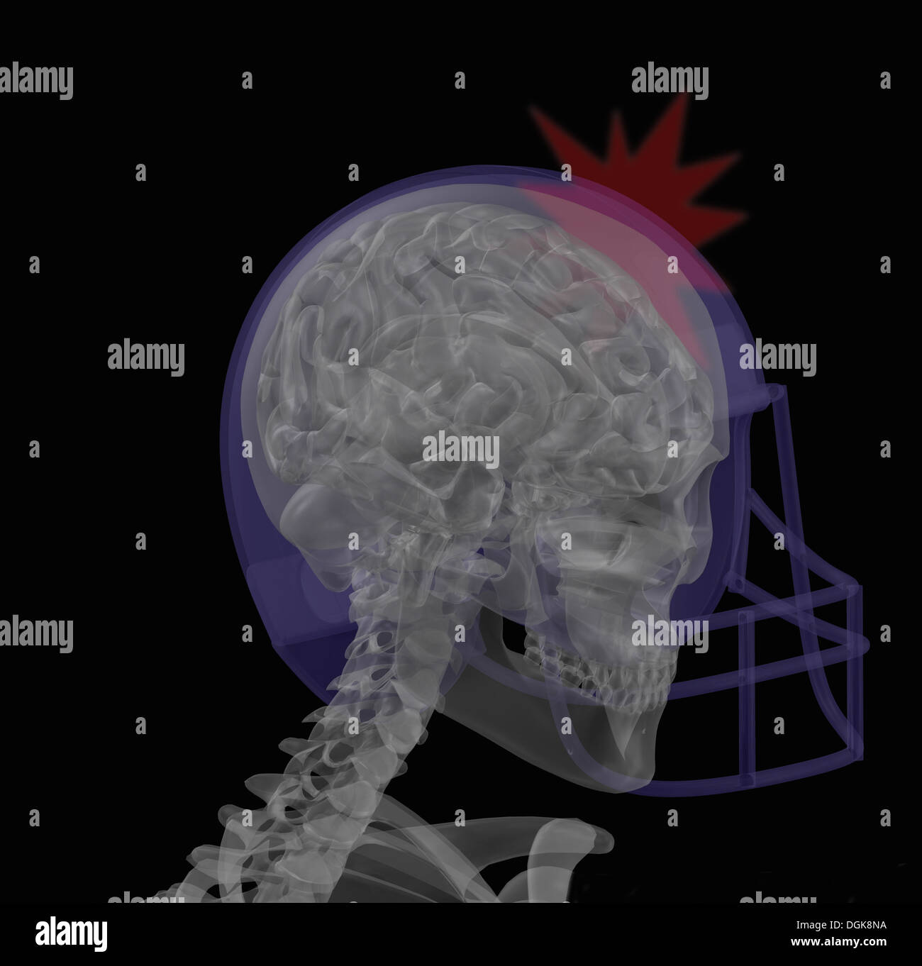 Illustration of a football player with concussion Stock Photo - Alamy