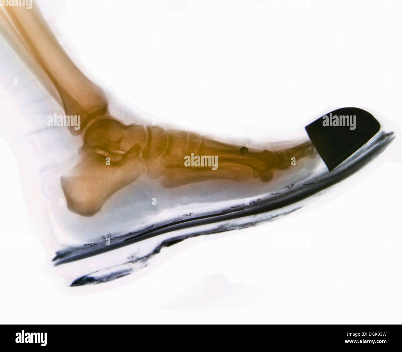 Colorized x-ray of foot in a steel-toed work boot Stock Photo - Alamy