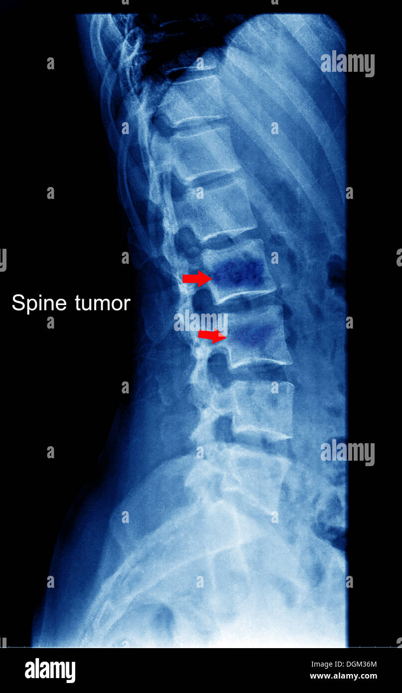 X-radiation (composed of X-rays) is a form of electromagnetic radiation ...