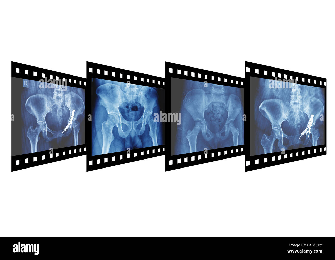 X-radiation (composed of X-rays) is a form of electromagnetic radiation ...