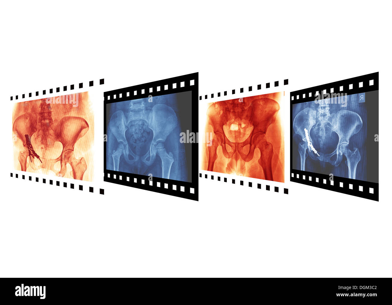 X-radiation (composed of X-rays) is a form of electromagnetic radiation ...