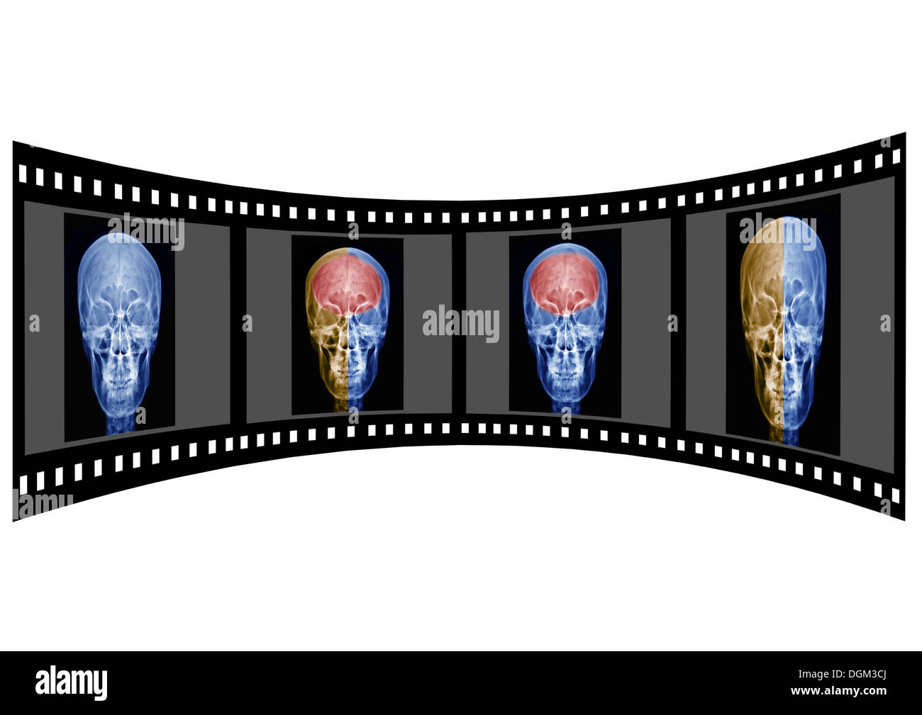 X-radiation (composed of X-rays) is a form of electromagnetic radiation ...