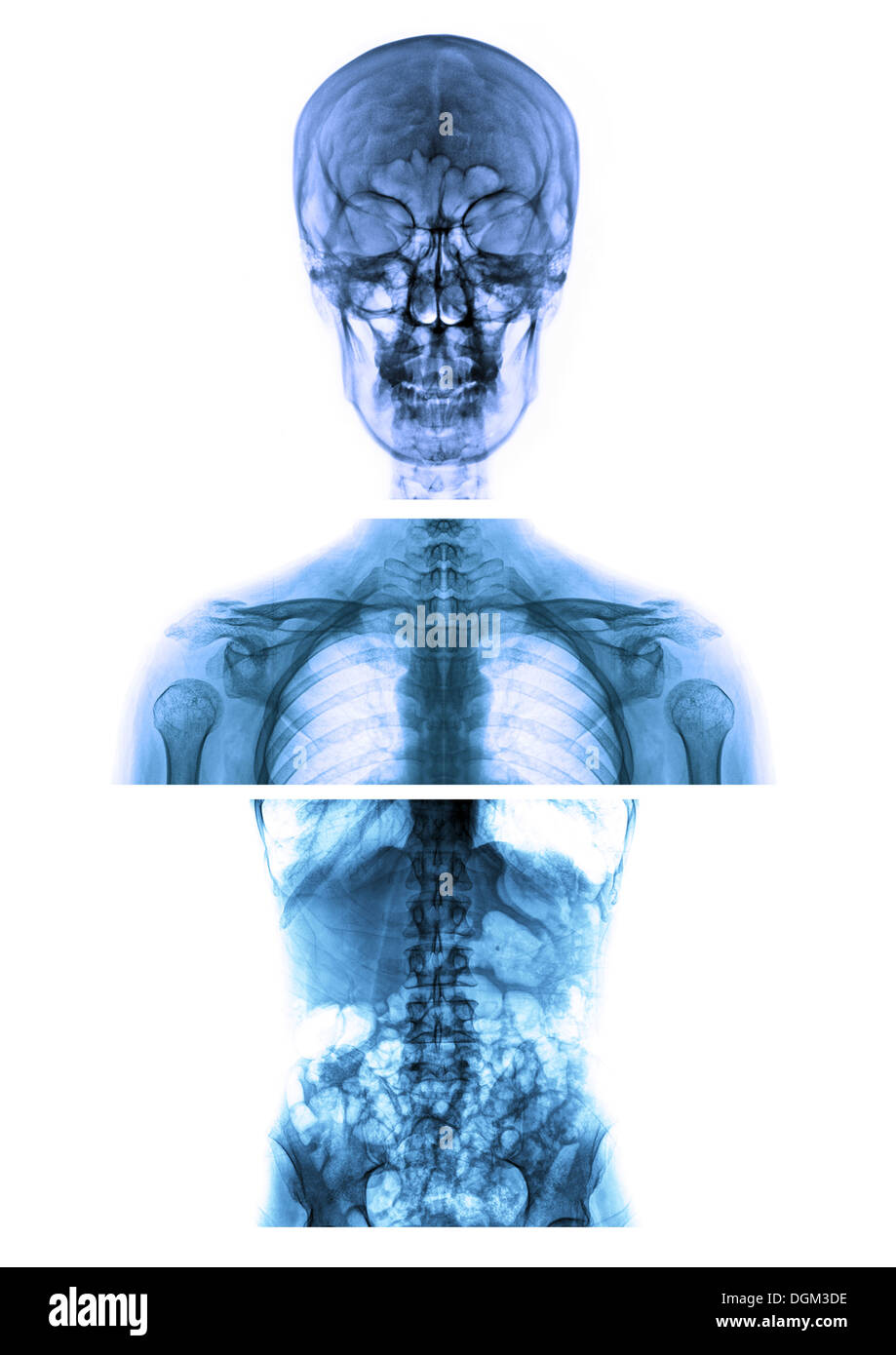 X-radiation (composed of X-rays) is a form of electromagnetic radiation ...