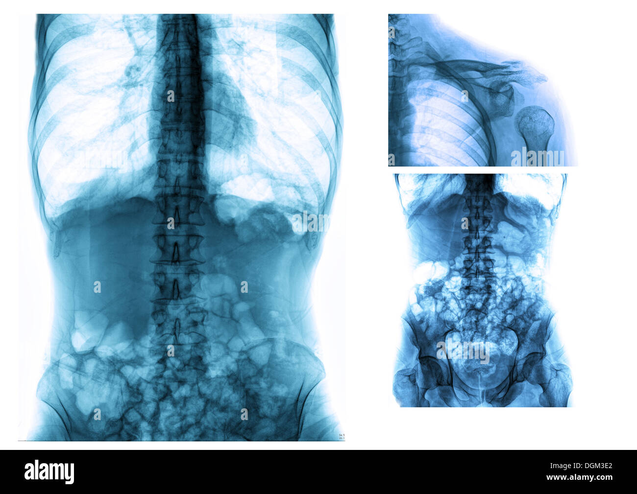 X-radiation (composed of X-rays) is a form of electromagnetic radiation ...