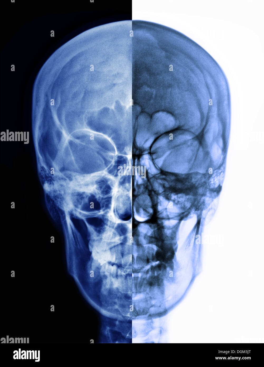 X-radiation (composed of X-rays) is a form of electromagnetic radiation ...