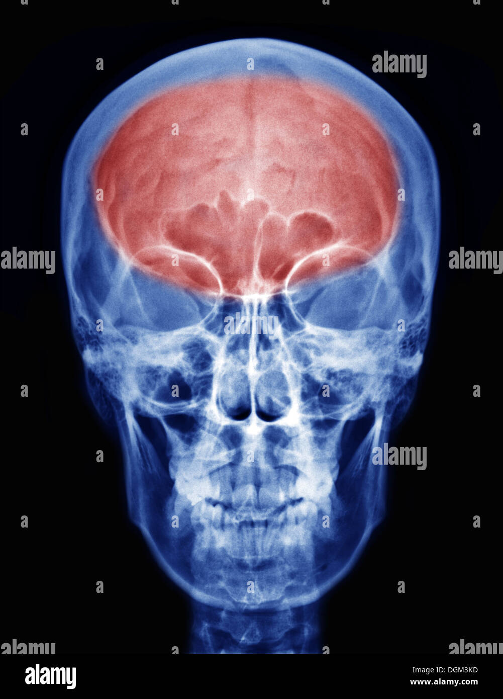 X-radiation (composed of X-rays) is a form of electromagnetic radiation ...