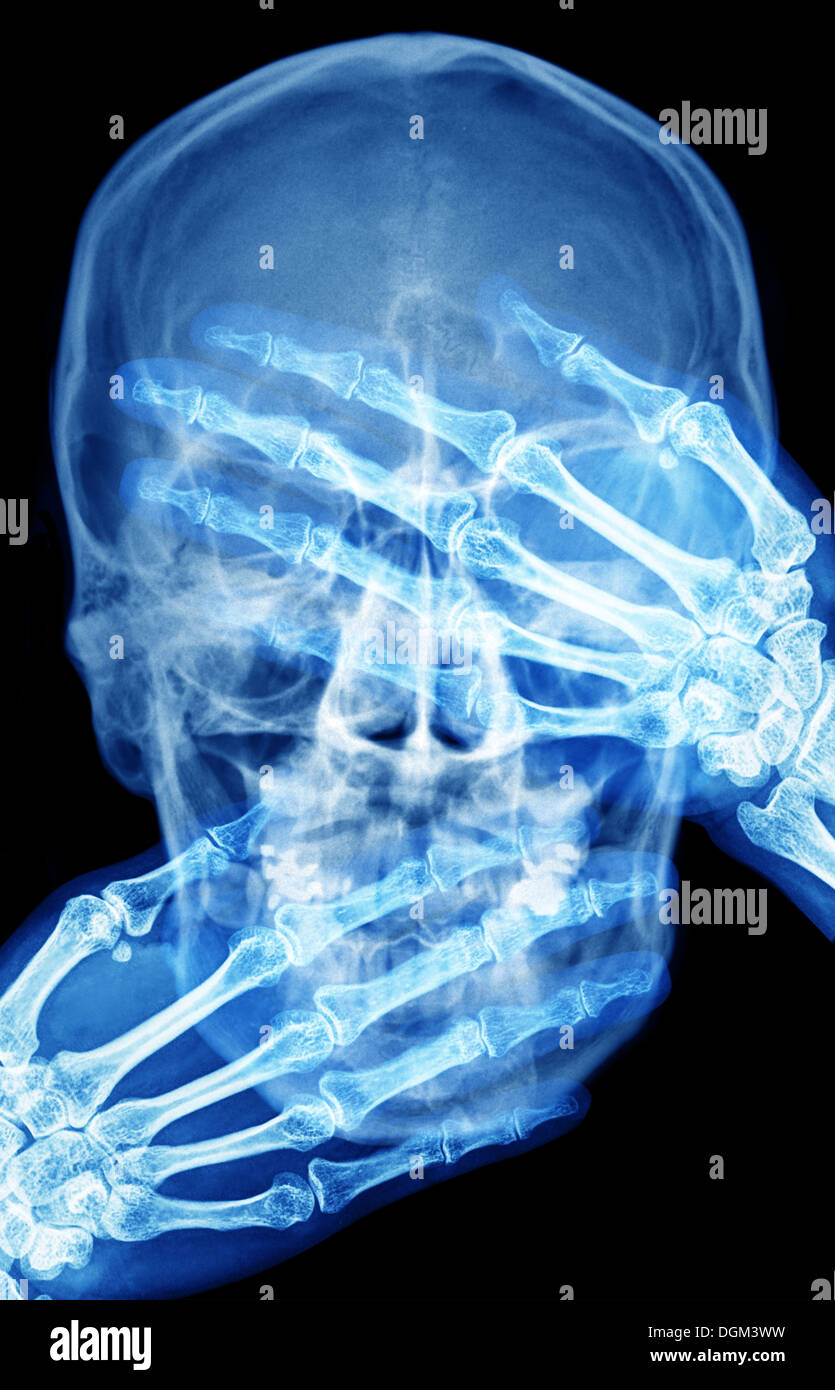 X-radiation (composed of X-rays) is a form of electromagnetic radiation ...