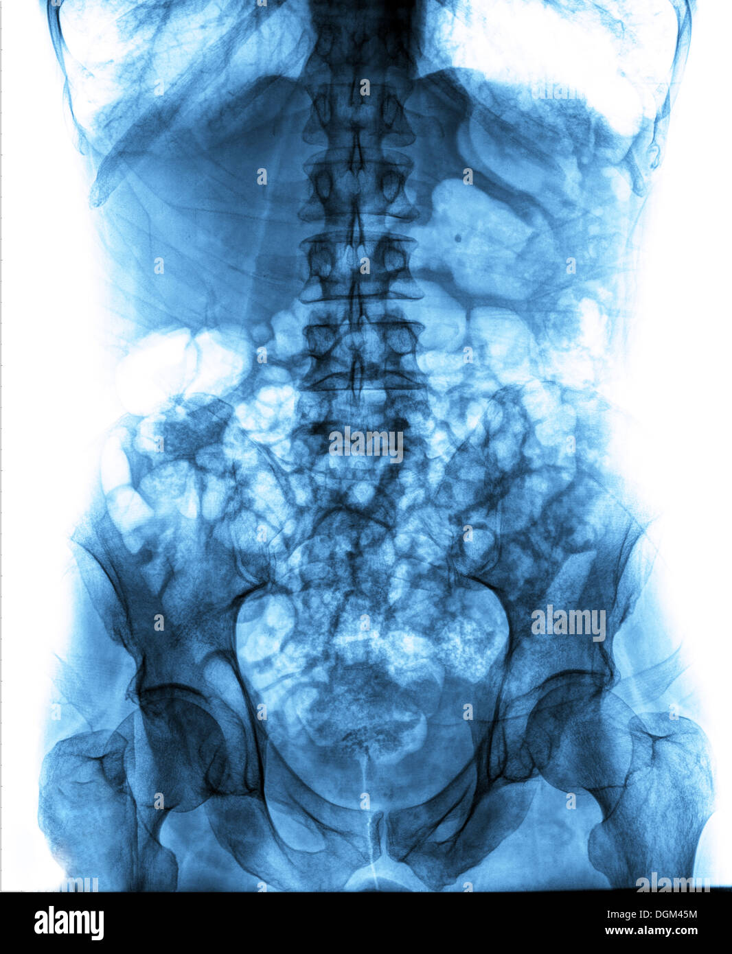 X-radiation (composed of X-rays) is a form of electromagnetic radiation ...