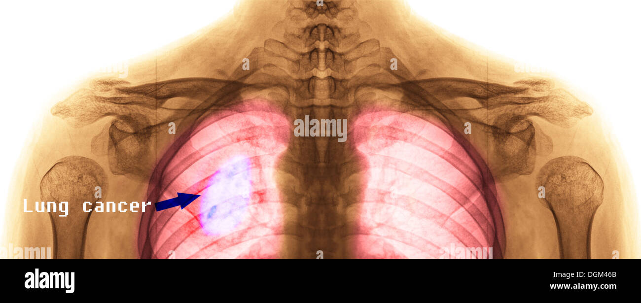 X-radiation (composed of X-rays) is a form of electromagnetic radiation ...