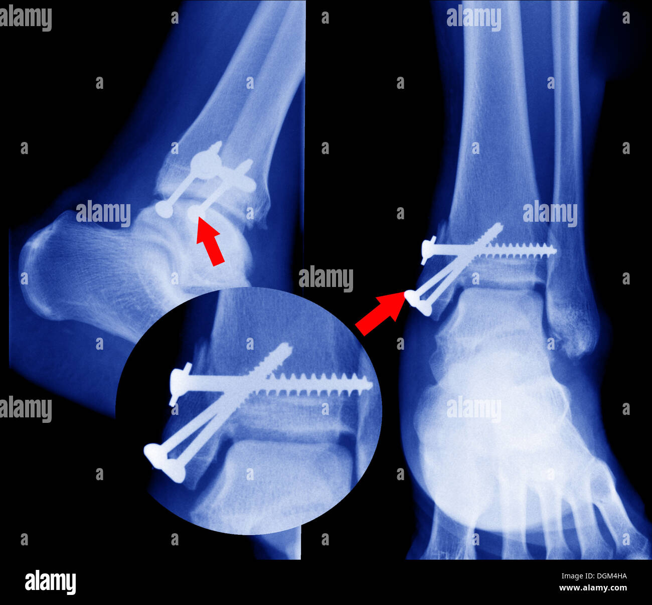 X-radiation (composed of X-rays) is a form of electromagnetic radiation ...