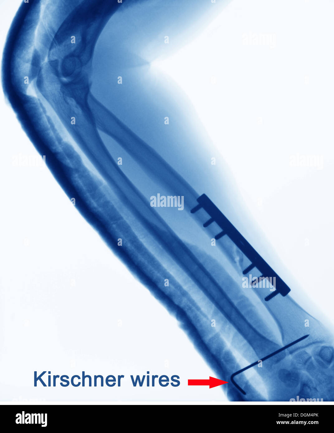 X-radiation (composed of X-rays) is a form of electromagnetic radiation ...