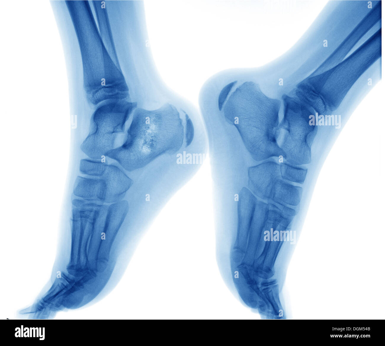 X-radiation (composed of X-rays) is a form of electromagnetic radiation ...