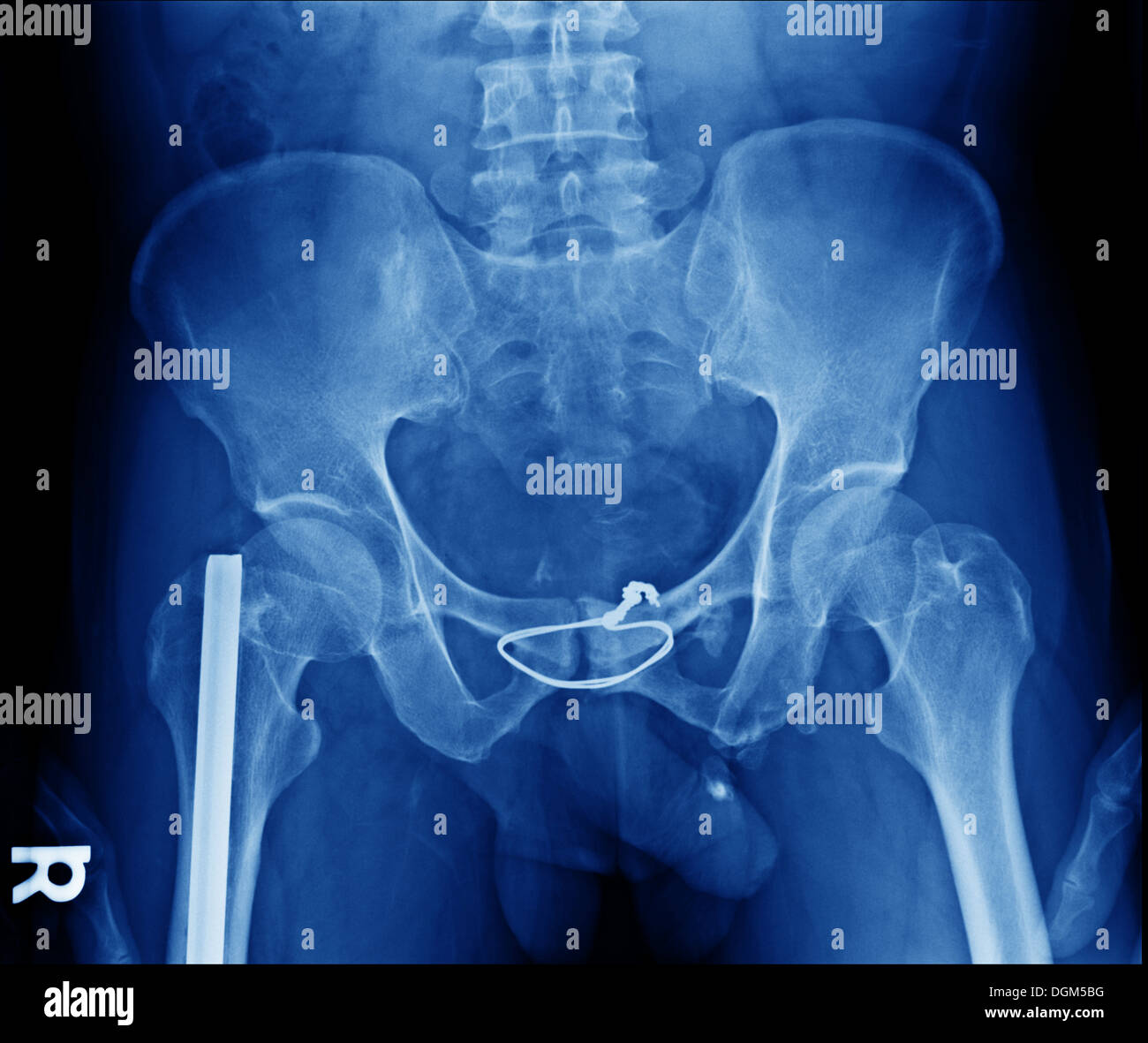 X-radiation (composed of X-rays) is a form of electromagnetic radiation ...