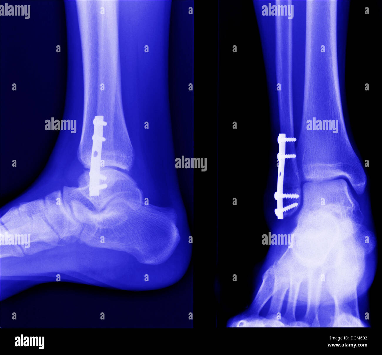 X-radiation (composed of X-rays) is a form of electromagnetic radiation ...